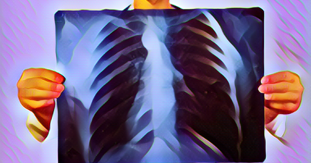 Scientists use microbots to cure mice of pneumonia - The Big Smoke